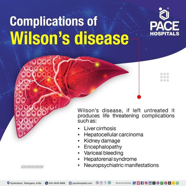Wilson's Disease Treatment PDF) Diagnosis And Treatment Of Wilson