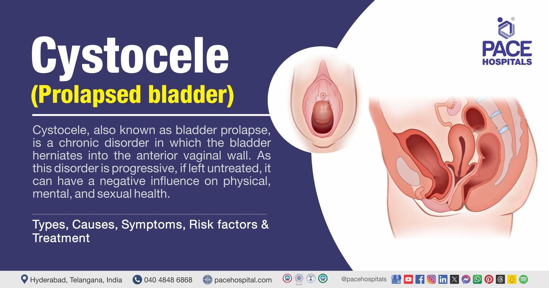 Best Hospital In Hyderabad India Multi Super Speciality Hospitals Best Hospital In Hyderabad India Multi Super Speciality Hospitals