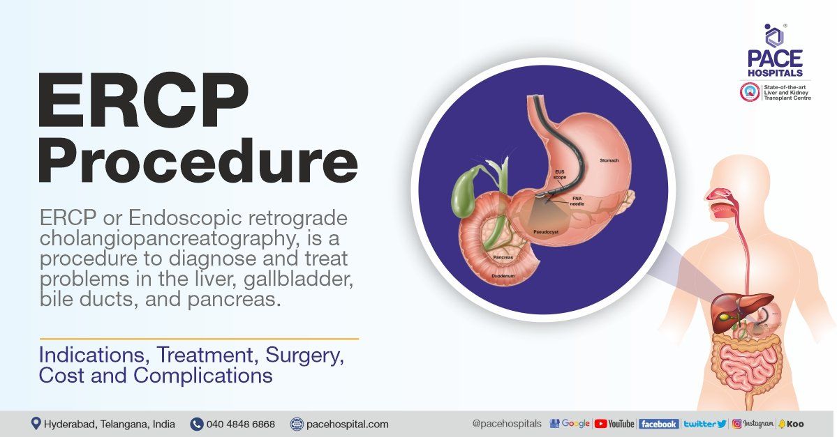 ERCP Procedure In Hyderabad Indications Surgery Cost And Treatment