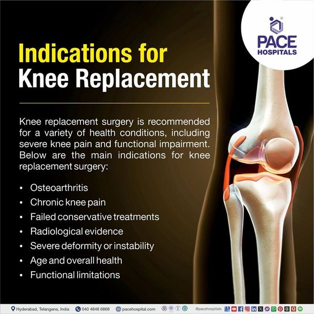 What Types Of Total Knee Replacement Are There In India - Infoupdate.org