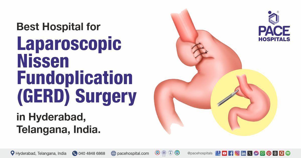 Best Laparoscopic Fundoplication Surgery in Hyderabad, India