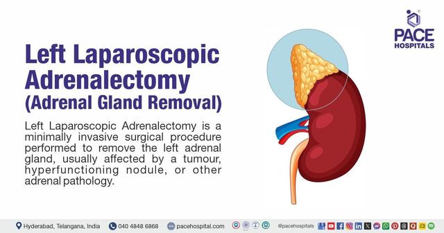 Adrenalectomy Side Effects Preparing For Robotic Adrenalectomy: What