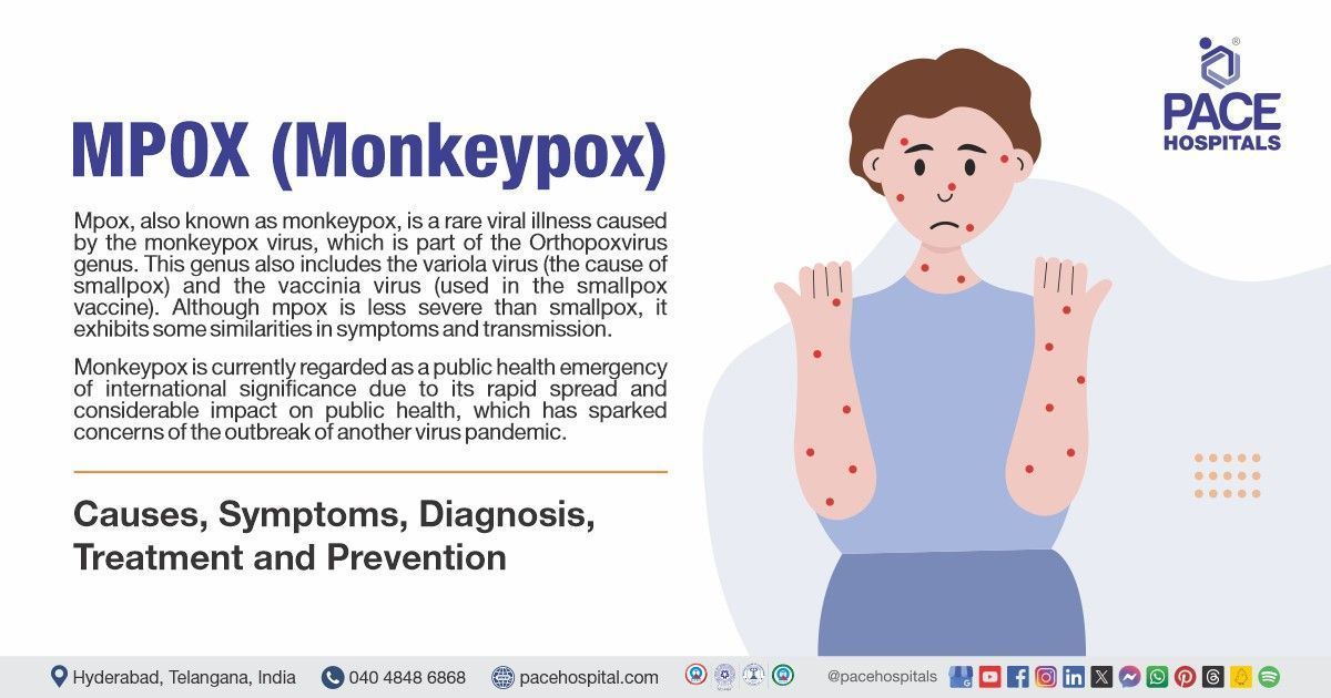 Mpox (monkeypox) - Symptoms, Causes, Treatment and Prevention