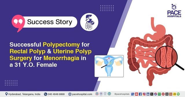 Rectal Polyp Polypectomy