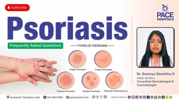 Comprehensive Guide to Psoriasis by Dr. Sowmya Samhitha G