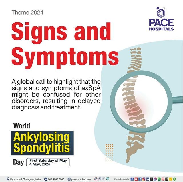 Ankylosing Spondylitis Treatment Ankylosing Spondylitis: Symptoms,