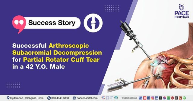 subacromial space decompression