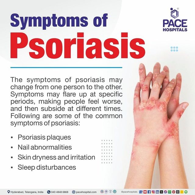 Psoriatic Arthritis Symptoms Pictures Treatment Psoriatic Arthritis Symptoms Pictures Treatment