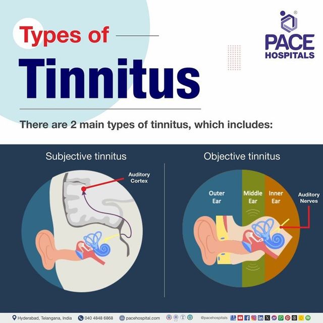 Tinnitus in right ear causes deals