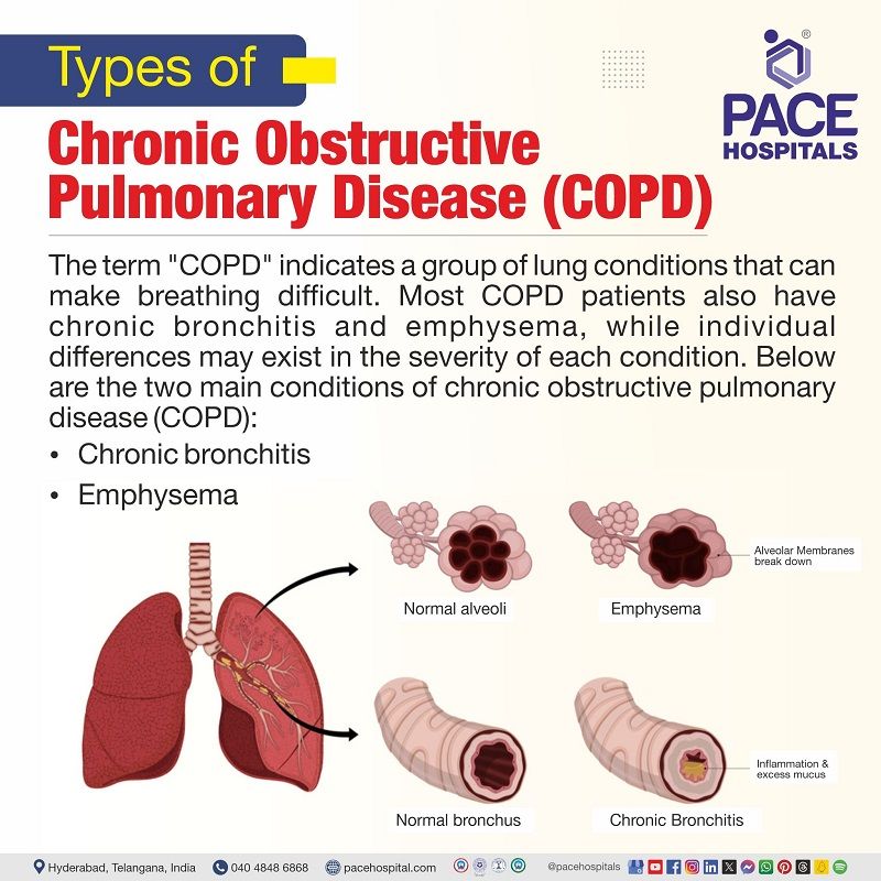 COPD - Symptoms, Causes, risk factors, Prevention and Treatment