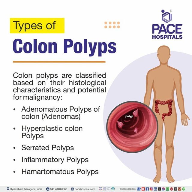 What Is Colonic Mucosa With Adenomatous Change Infoupdate What Is Colonic Mucosa With Adenomatous Change Infoupdate