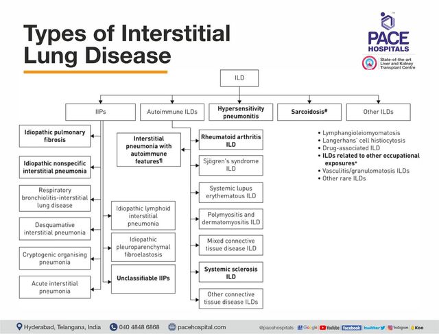 Acute Interstitial Pneumonia