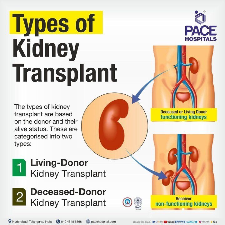 Best Hospital For Kidney Transplant In Hyderabad Cost Success Rate Best Hospital For Kidney Transplant In Hyderabad Cost Success Rate