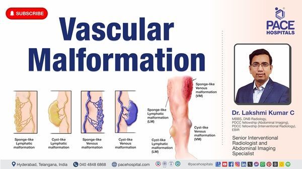 Interventional Radiologist Guide all about Vascular Malformation