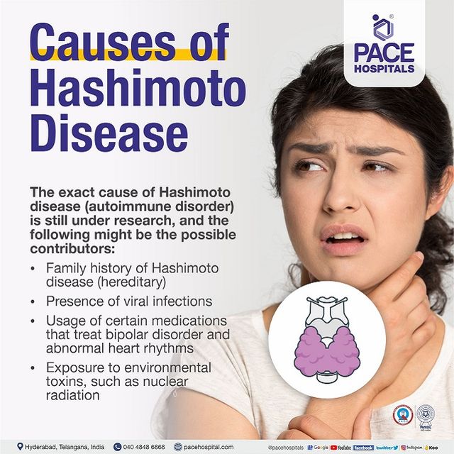 Does Hashimoto S Cause Eye Problems Infoupdate
