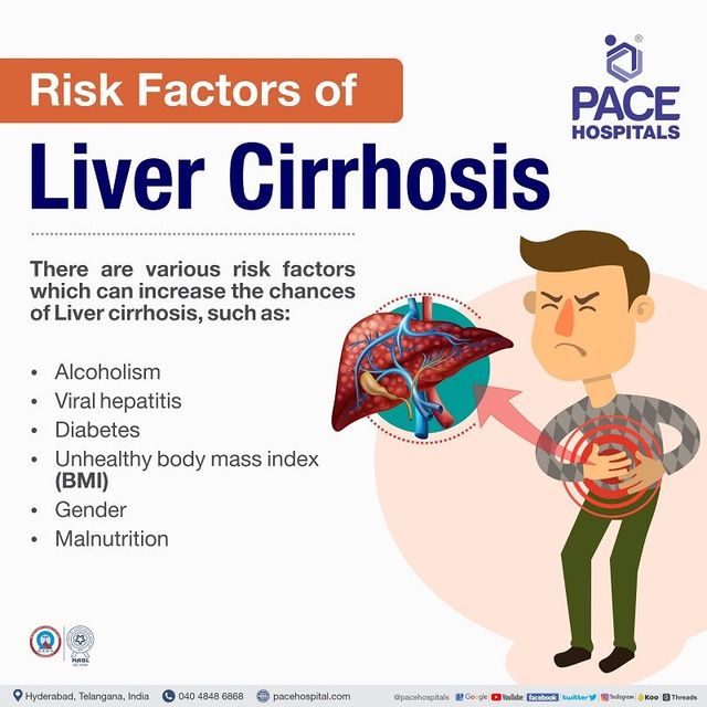 Cirrhosis Cirrhosis