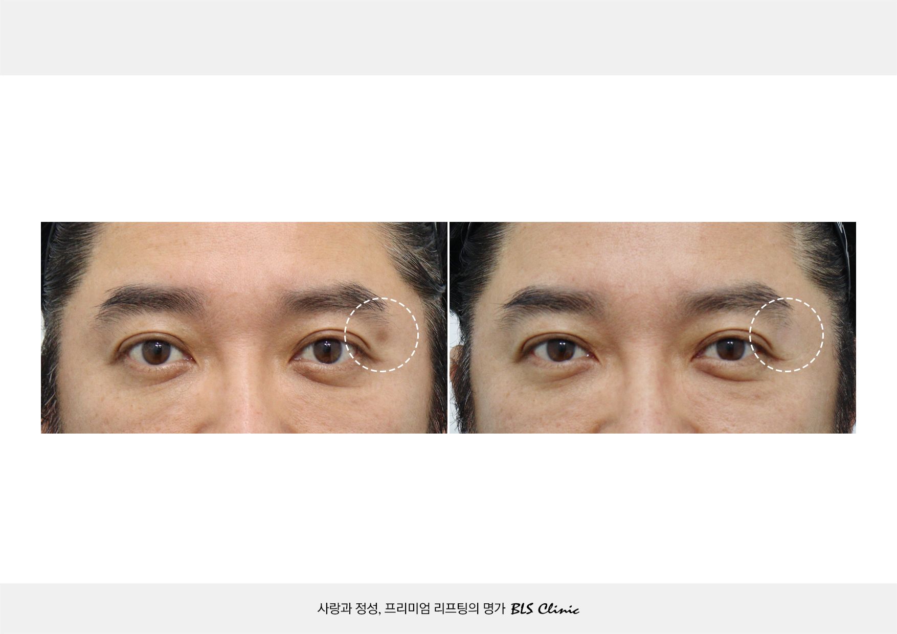 Cheongdam Skin Clinic - Cheongdam Aesthetics