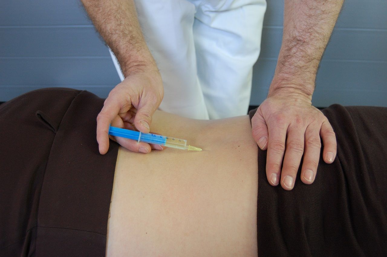 Epidural Steroid Injections for Chronic Back Pain Relief