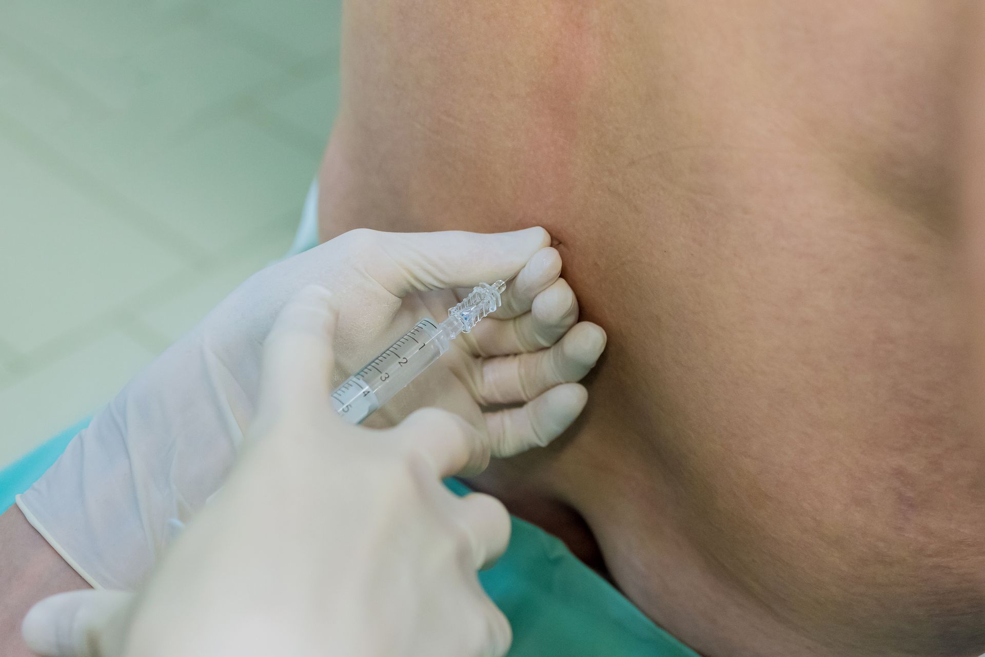A Deep Dive into Epidural Injections for Pain Management