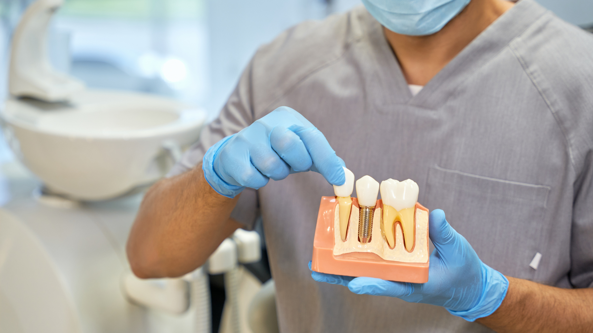 How Long Do Dental Implants Last? A Comparison of Inlays, Onlays, and ...