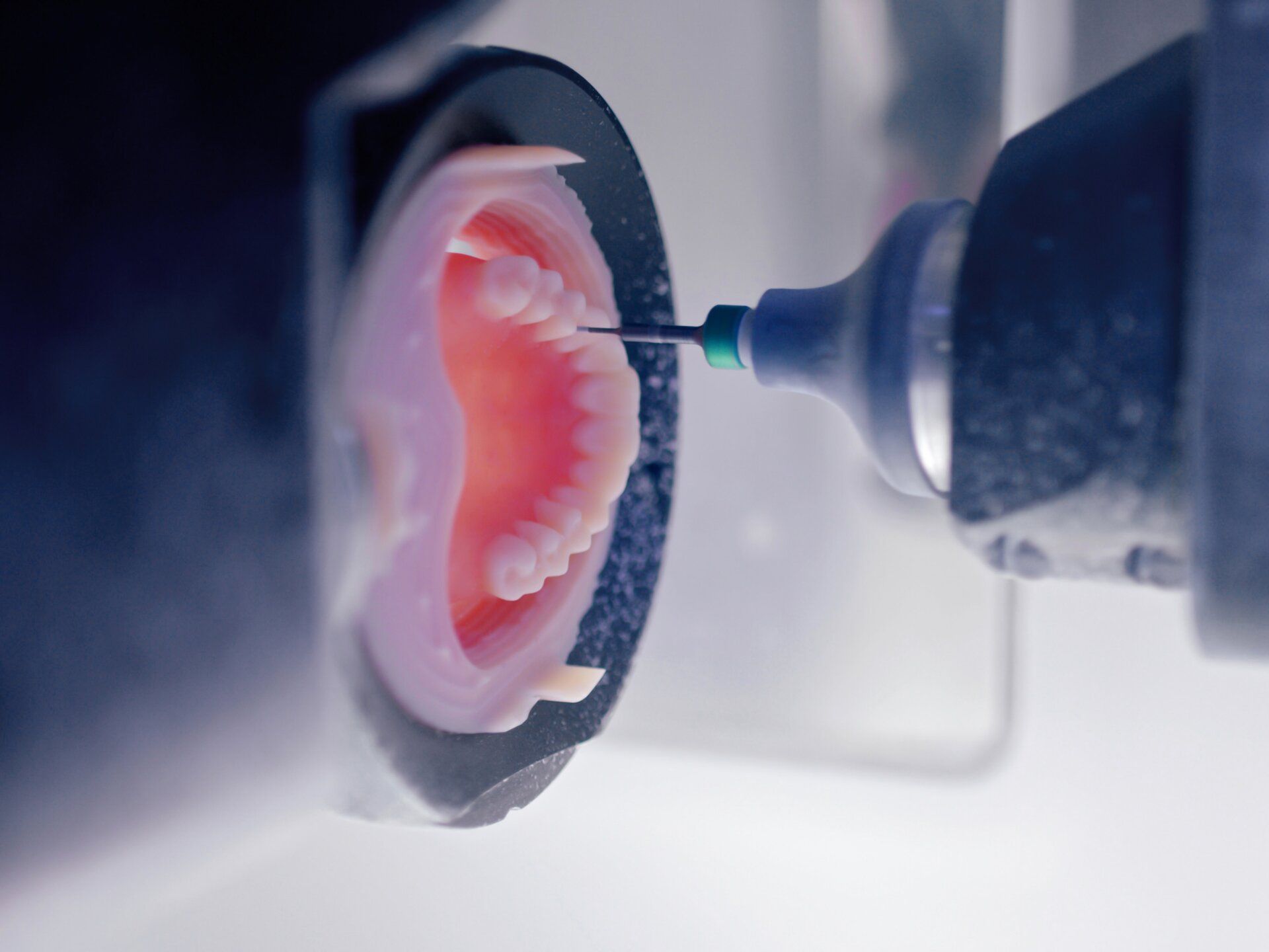 Digital Dentures In Surrey | High-Class, Precision Dentures