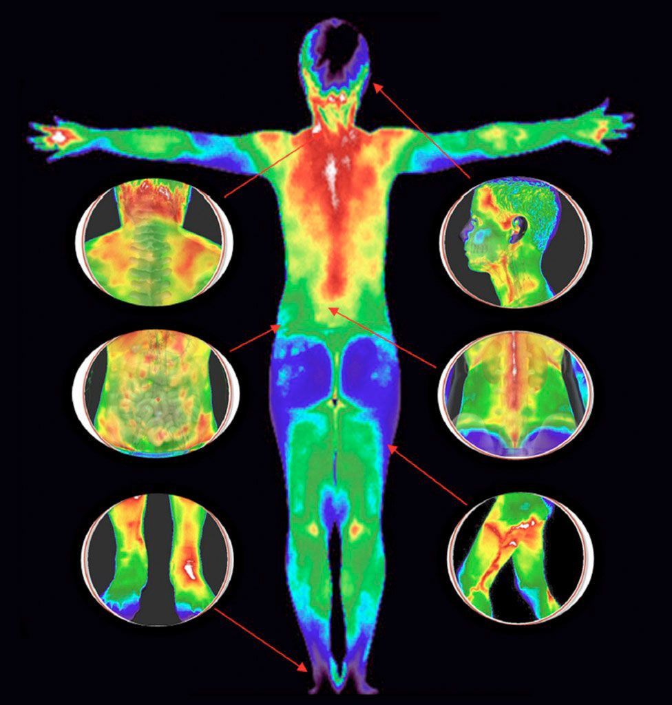 Home - Choice Thermography and Wellness Center