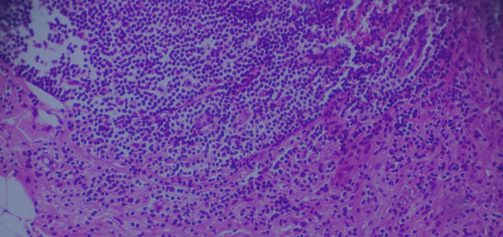 Improving Pathology Diagnosis and Treatment Because Days Matter