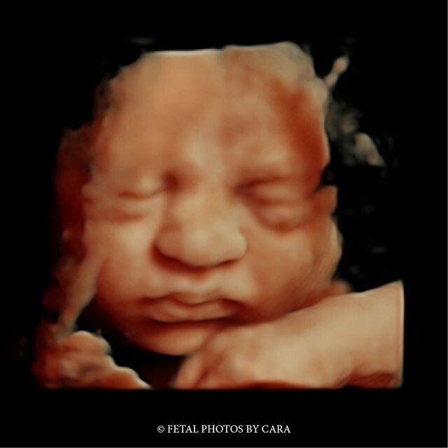 Gallery | Fetal Photos by Cara