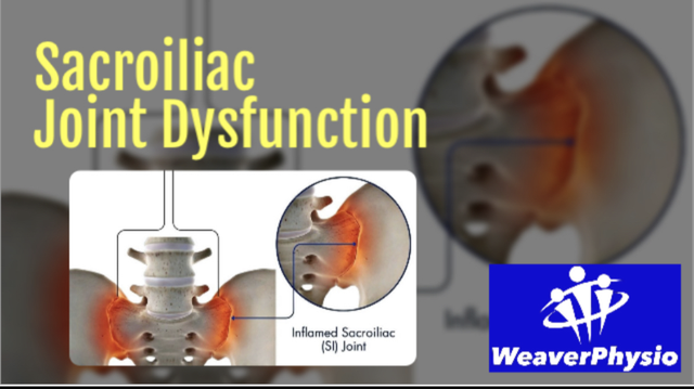 Sacroiliac Joint Dysfunction Causes Diagnosis And Treatment