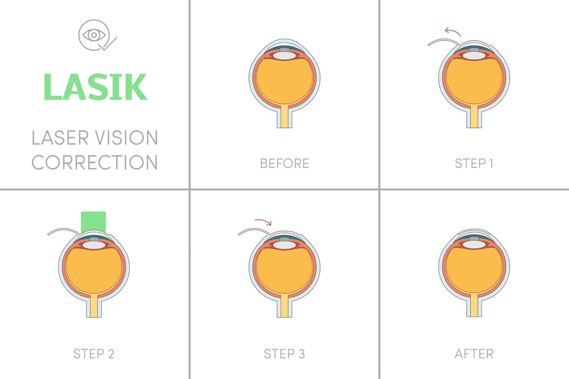 What Is Nearsighted And Farsighted? | Holly Springs Eye & Laser