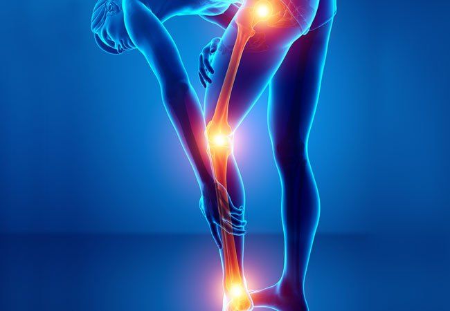 Complex Regional Pain Syndrome (CRPS)