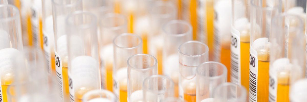 Metabolic Disorders | Anti-Obesity & Anti-Diabetic Assays | Pharmidex