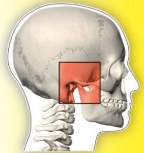 Correcting TMJ with Braces for Lasting Relief