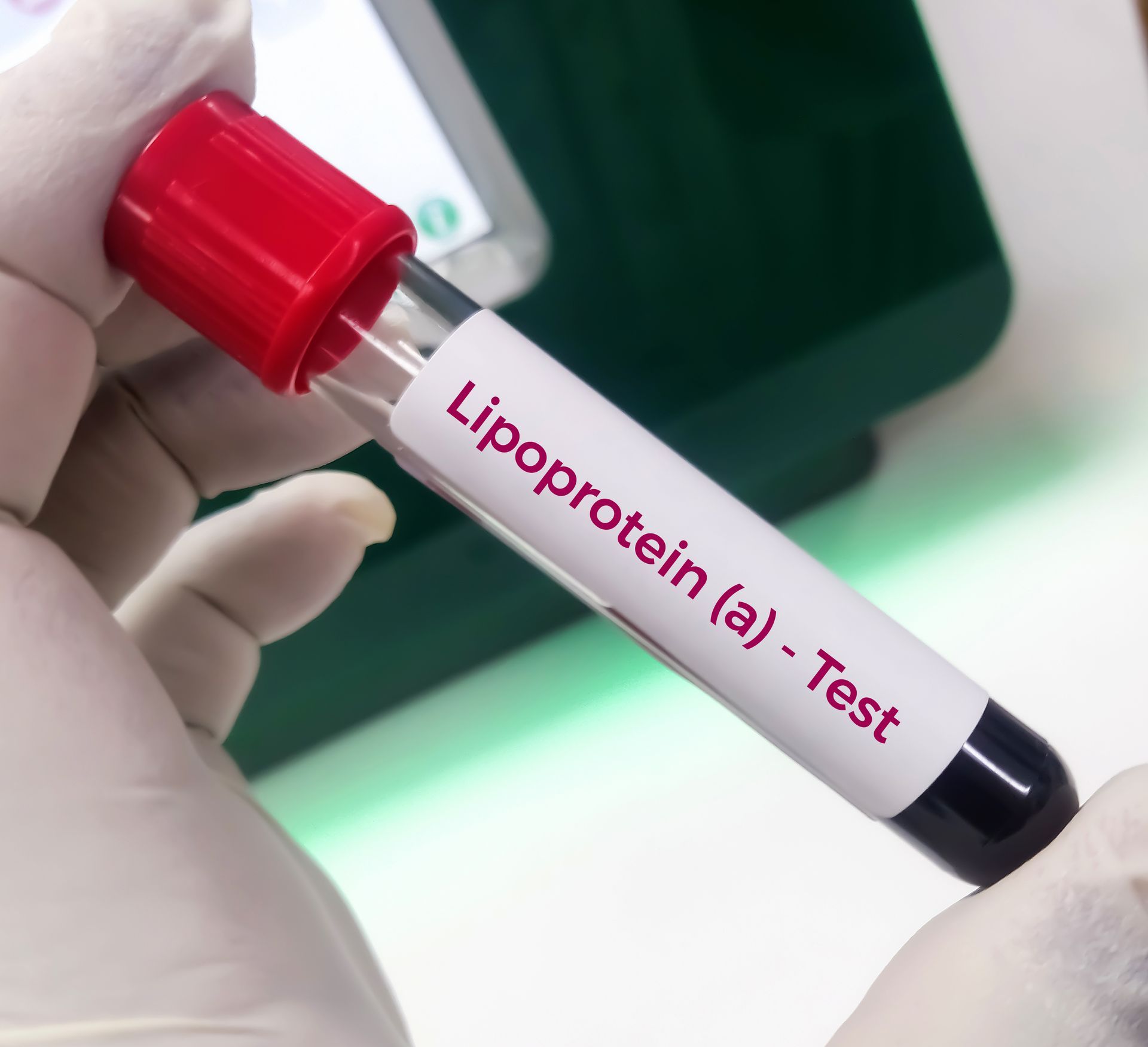 Una de cada 5 personas presenta la lipoproteína(a) elevada, un ...