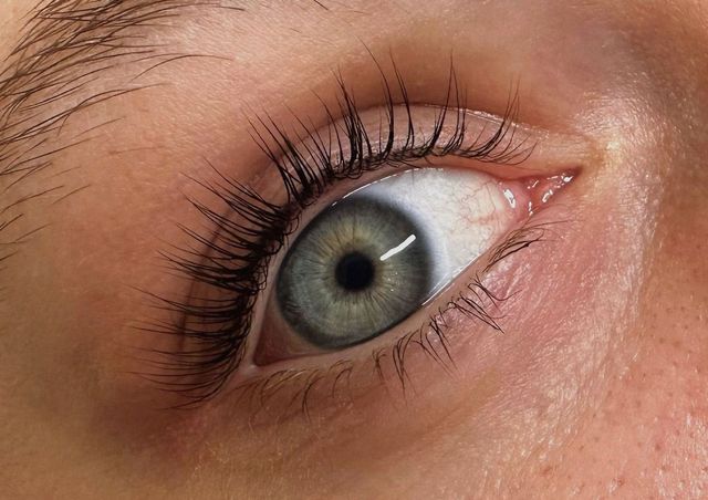 Double Row Eyelashes Mutation
