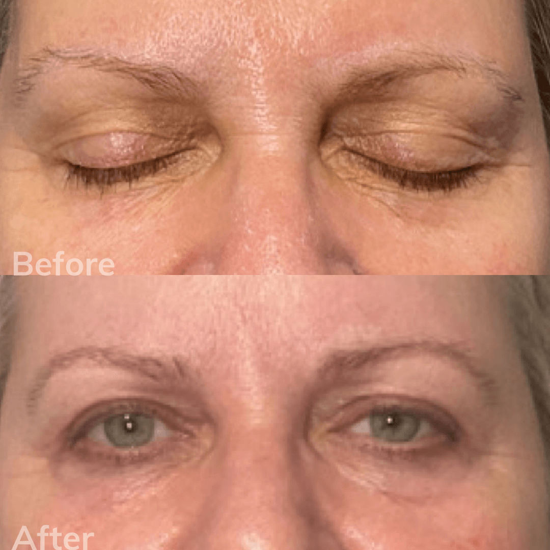 PRP Southern California | The Studio Med Spa San Marcos