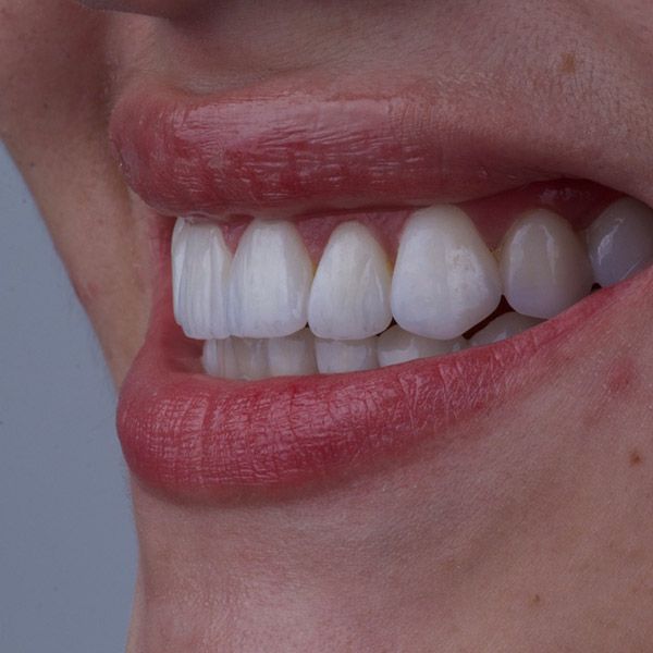 Aesthetic Dental Care | Dental Cosmetics