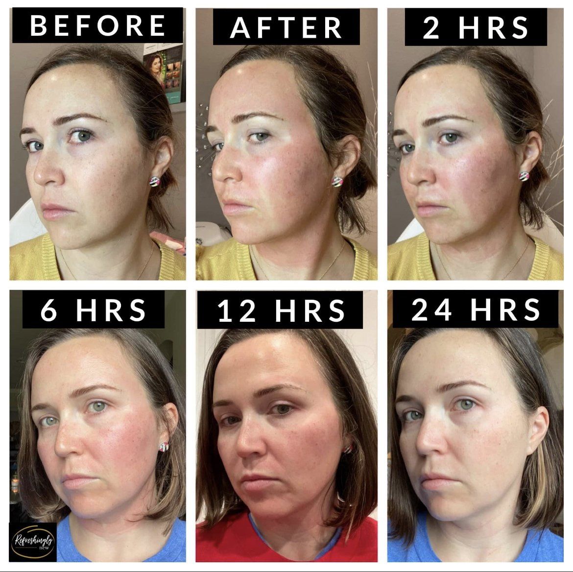 Refreshingly New | Medical Aesthetics Spa