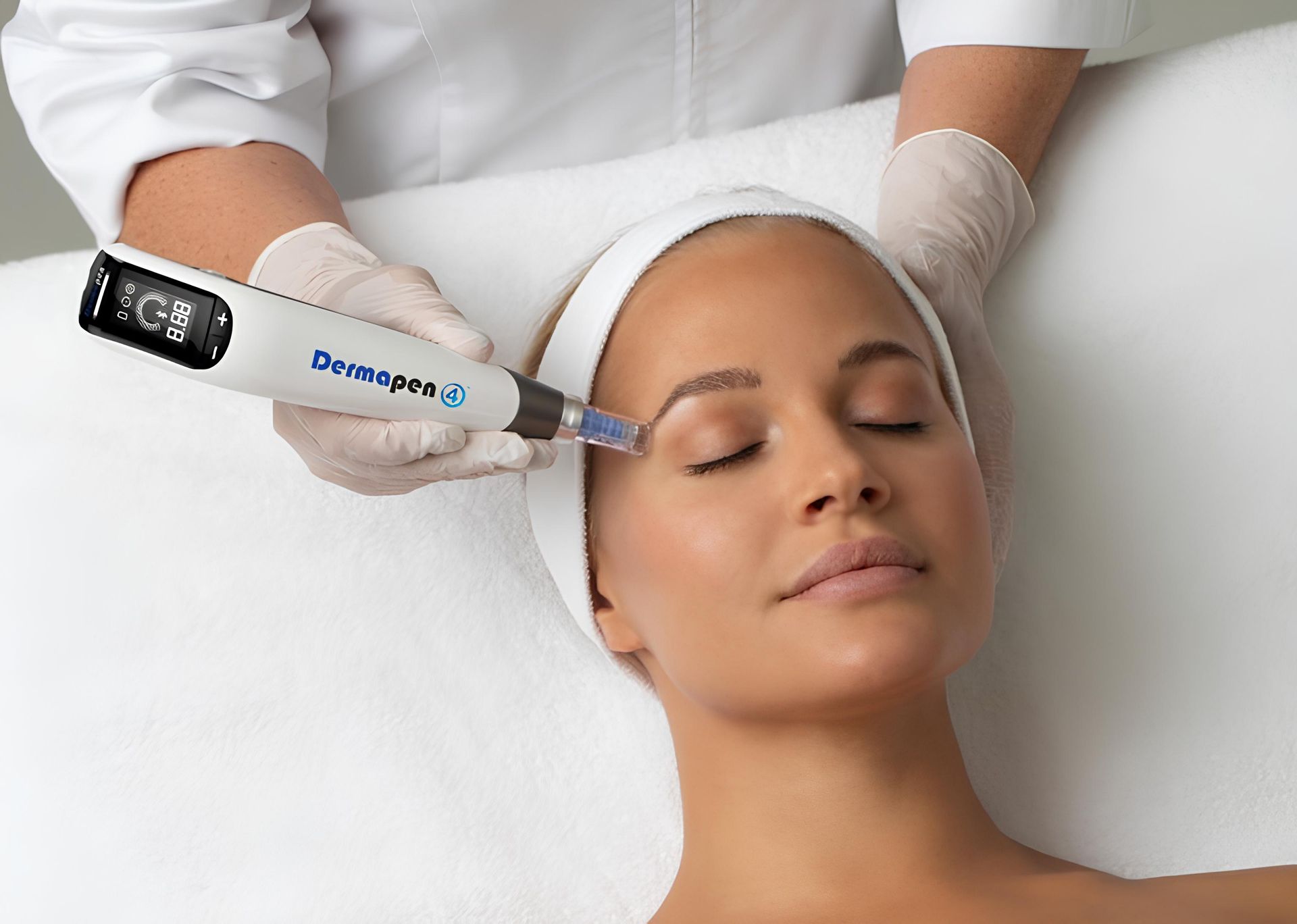 Microneedling | Val Caron, ON | Complete Beauty And Rejuvenation Solutions