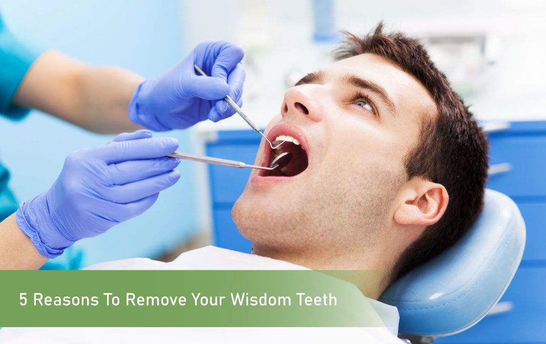 5 Reasons To Remove Your Wisdom Teeth
