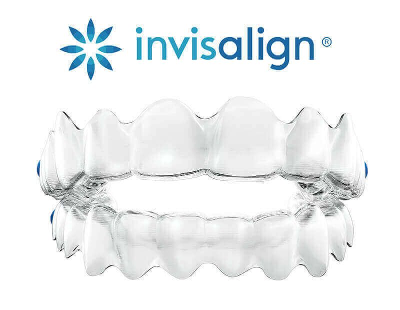 Invisalign