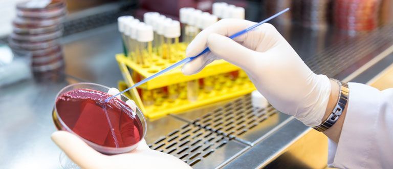 What Type of Lab Food Testing Does My Product Need?