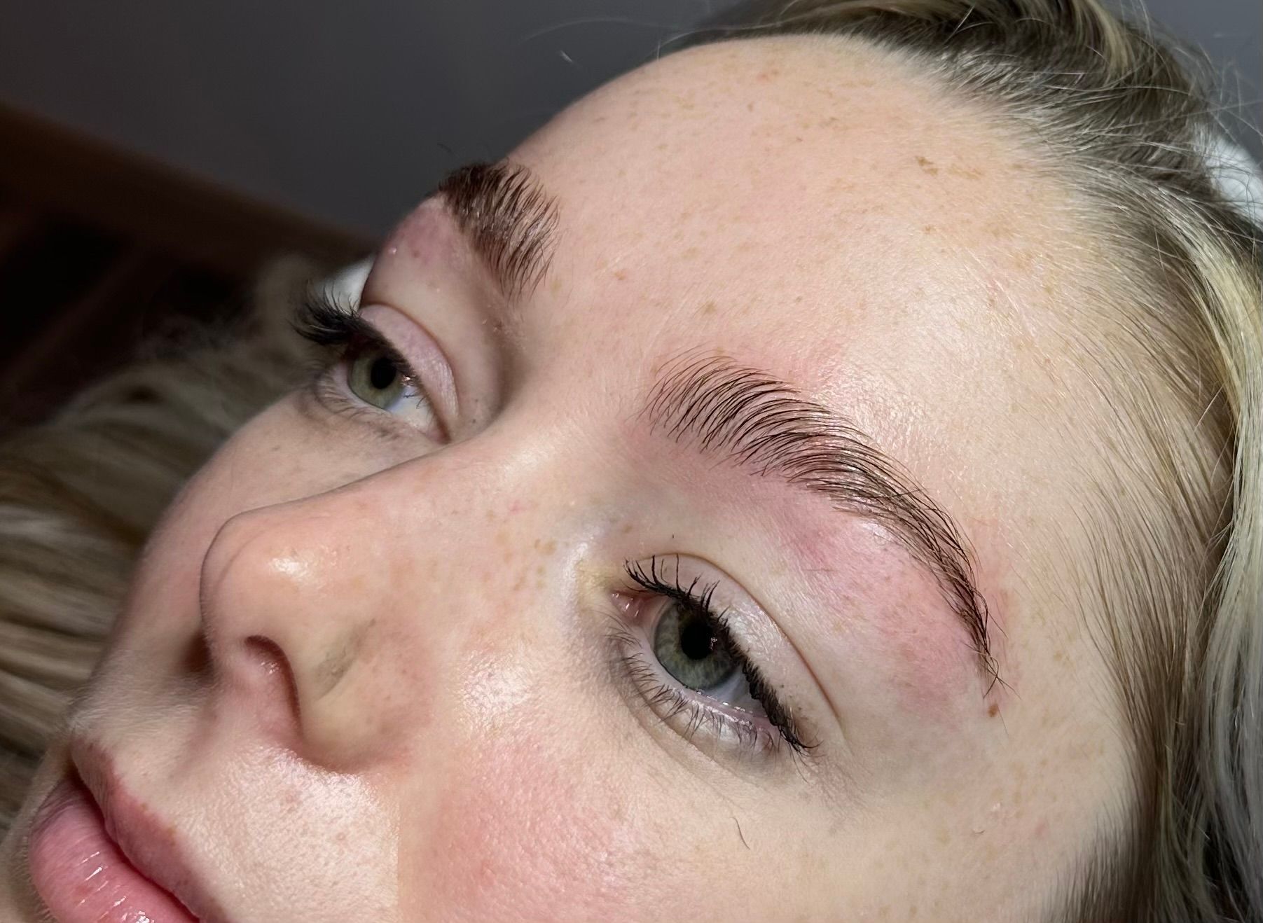 Gallery - Dyer, IN - Refresh Med Spa