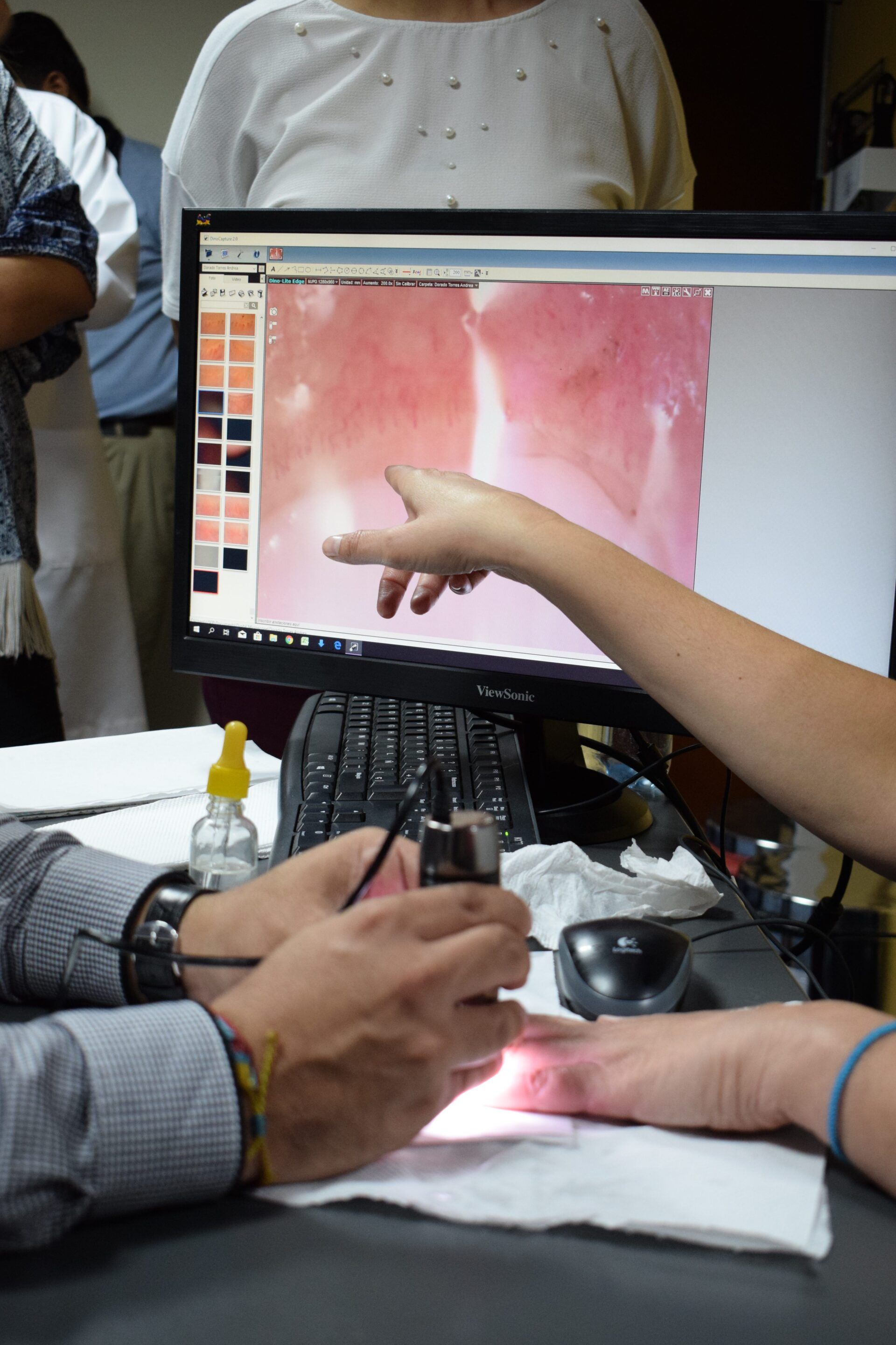 Curso de Capilaroscopía 2019 | Reumatología Perú