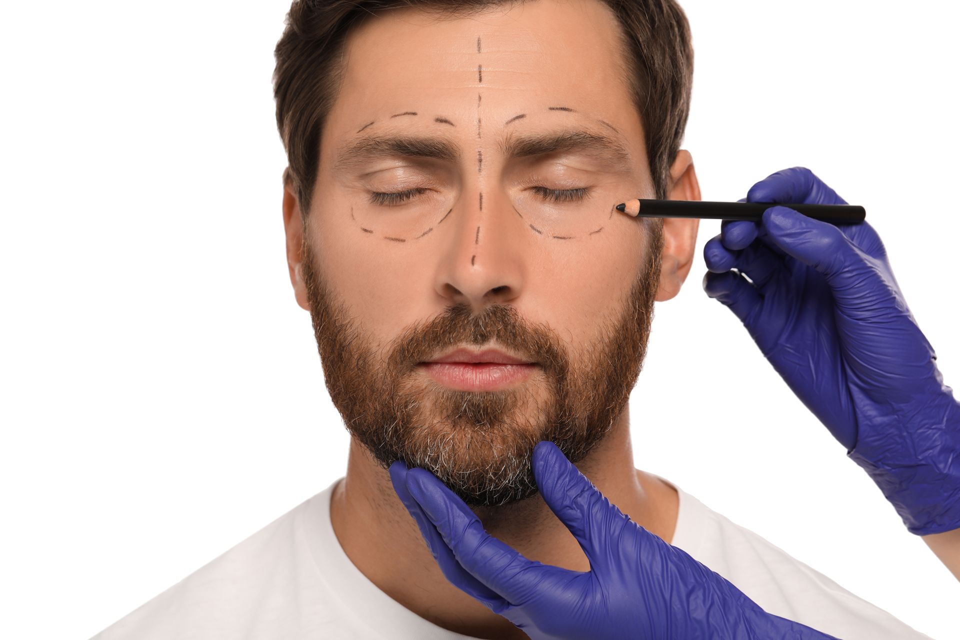 Asfa Plastic Surgery | Eyelid Surgery