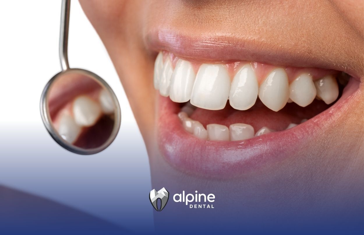 What Is Tooth Enamel? Function and Care | Alpine Dental
