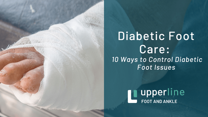 10 Ways to Control Diabetic Foot Issues