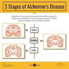 The Three Stages of Dementia