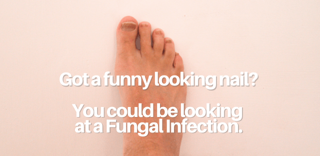 Funny nails - The truth about fungal toes