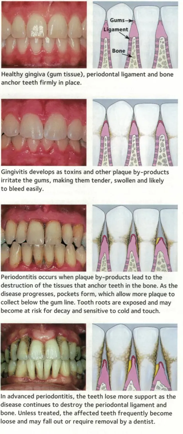 Healthy Gums Color